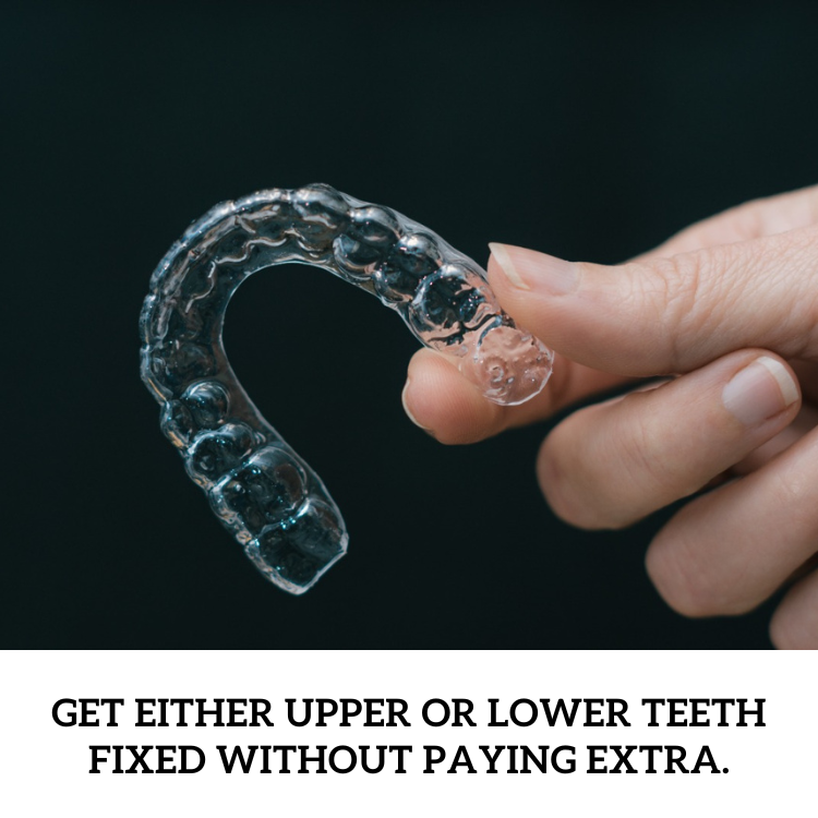 Buy Smileie Night Time Invisible Braces Single Arch with easy instalment